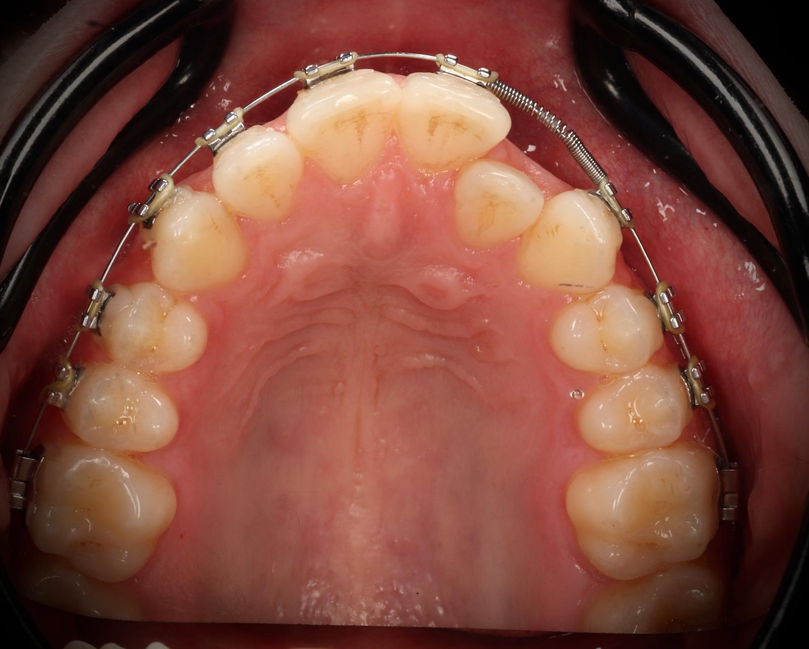 Cosmetic Dentistry Treatments Newquay - Green Room Dentistry